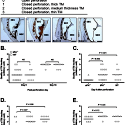 Characterization of the quality of TM healing.
