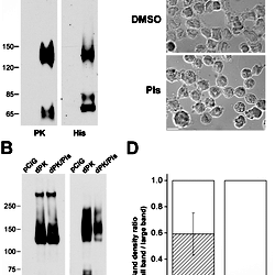 Pikachurin fragments present in the conditioned medium of Y79 cells.