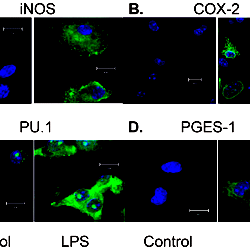 Confocol fluorescent microscopy detects the expression and ...