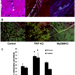 Inflammatory infiltrate is higher in TRIF KO than MyD88KO or control mice.