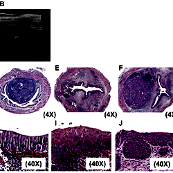 Bladder wall injection with S. haematobium eggs triggers granuloma ...