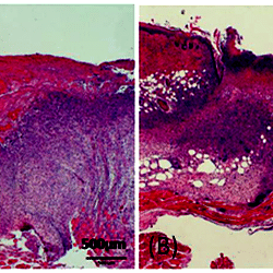 Microscopic images of granulation tissue.