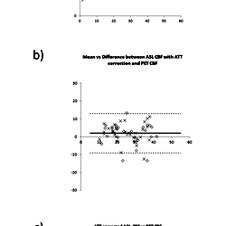 Linear regression analysis of PET-CBF and ASL-CBF.