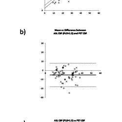 Linear regression analyses of PET-CBF and ASL-CBF.