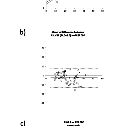 Linear regression analyses of PET-CBF and ASL-CBF.