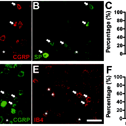 Colocalization of substance P (SP) and isolectin B4-binding (IB4 ...