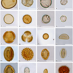 Photomicrographs of selected pollen grains recovered from the honey ...