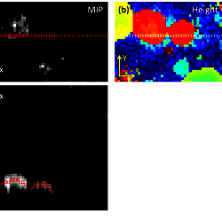 MIP and corresponding height view.