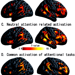 SPM results from the spatial attention task vs. control task (A ...