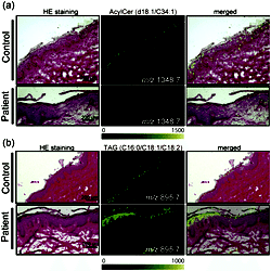 IMS analyses of clinical samples.