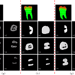 Segmentation and classification results for three MicroCT tooth datasets.
