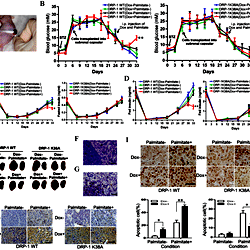 DRP-1 mediated FFA-induced INS-1-derived cell apoptosis in vivo.