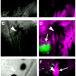 NC does not contribute to the cleithrum.