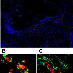 Microscopic distribution of Alexa647-labeled rapamycin nanoparticles in ...