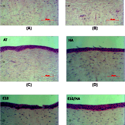 Representative pictures of H&E staining of corneal sections from the ...