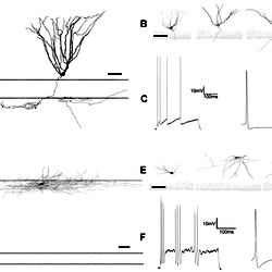 Camera lucida drawings and electrophysiological recordings of granular ectopic and small ...