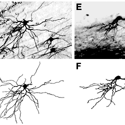 dLGN projection neurons labeled by injections of BDA into the visual ...