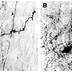 Photomicrographs showing the effects of varying post-injection survival ...