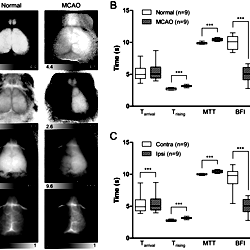 Types of CBF maps and a comparison of CBF parameters in normal and ...