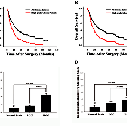 Immunohistochemical staining of BSP in glioma and normal brain tissues.
