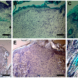 Tgfß3-Cre induced recombination in the suprabasal layers of the ...