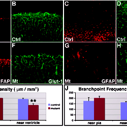 Recovery of vessel development in the upper cortex of class II orc3 ...