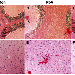 Pathology observed during ECM.
