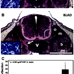 Lumbar spinal cord and pyknotic neurons at E13.5.