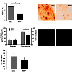 Evaluation of BBS1 treatment on Aβ content.