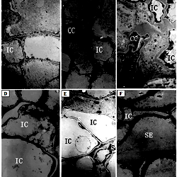 The ultrastructure of intermediary cells (IC) of phloem in lateral ...