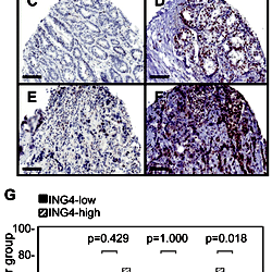 Inverse correlation between ING4 and p-p65/RelA (Ser276) antibody ...