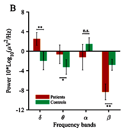 EEG power spectra.