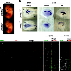Impairment of cortical hem formation and cell cycle progression in ...