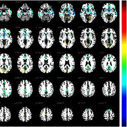 Brain areas exhibited significantly different FCs with the right V1 in ...