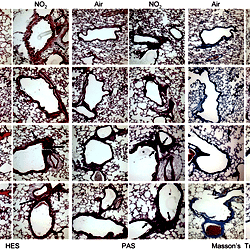 Representative histological images of HES (left columns), PAS (middle ...