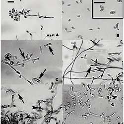 Morphology of Geomyces destructans varies with incubation temperature.