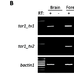 tor1 is expressed ubiquitously. A: