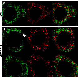 Fluorescence analysis of ER and mitochondria.