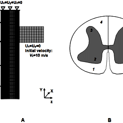 Simulation and regions in spinal cord tissue.