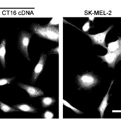 CT16 expression and location in cultured melanoma cells.