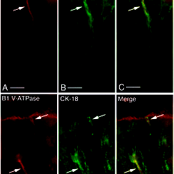 Dual immunofluorescence labeling for the V-ATPase B1 subunit isoform ...