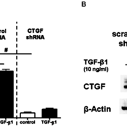Effect of CTGF shRNA on basal and TGF-β1 mediated induction of CTGF mRNA- and protein-expression ...