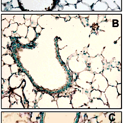 iNOS staining in airways of vagotomized mice.