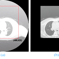 A Segmentation Method for Lung Parenchyma Image Sequences Based on Superpixels and a Self ...