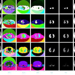 The segmentation results of using the watershed method.