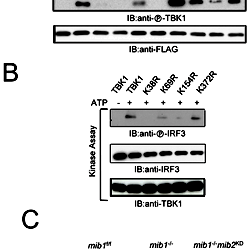 Ubiquitination regulates TBK1 kinase activity.