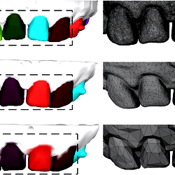 The segmentation results of employing our approach on three dental ...