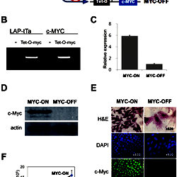 Biological characteristics of a conditional c-Myc mouse liver tumor ...