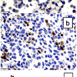 Caspase-3 staining for apoptosis or cell death.