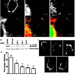 Requirement for DIP in non-apoptotic membrane blebbing.
